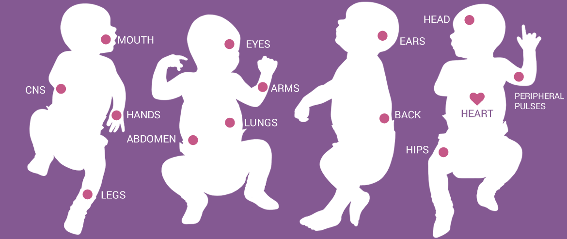 Newborn Baby Check | Bristol